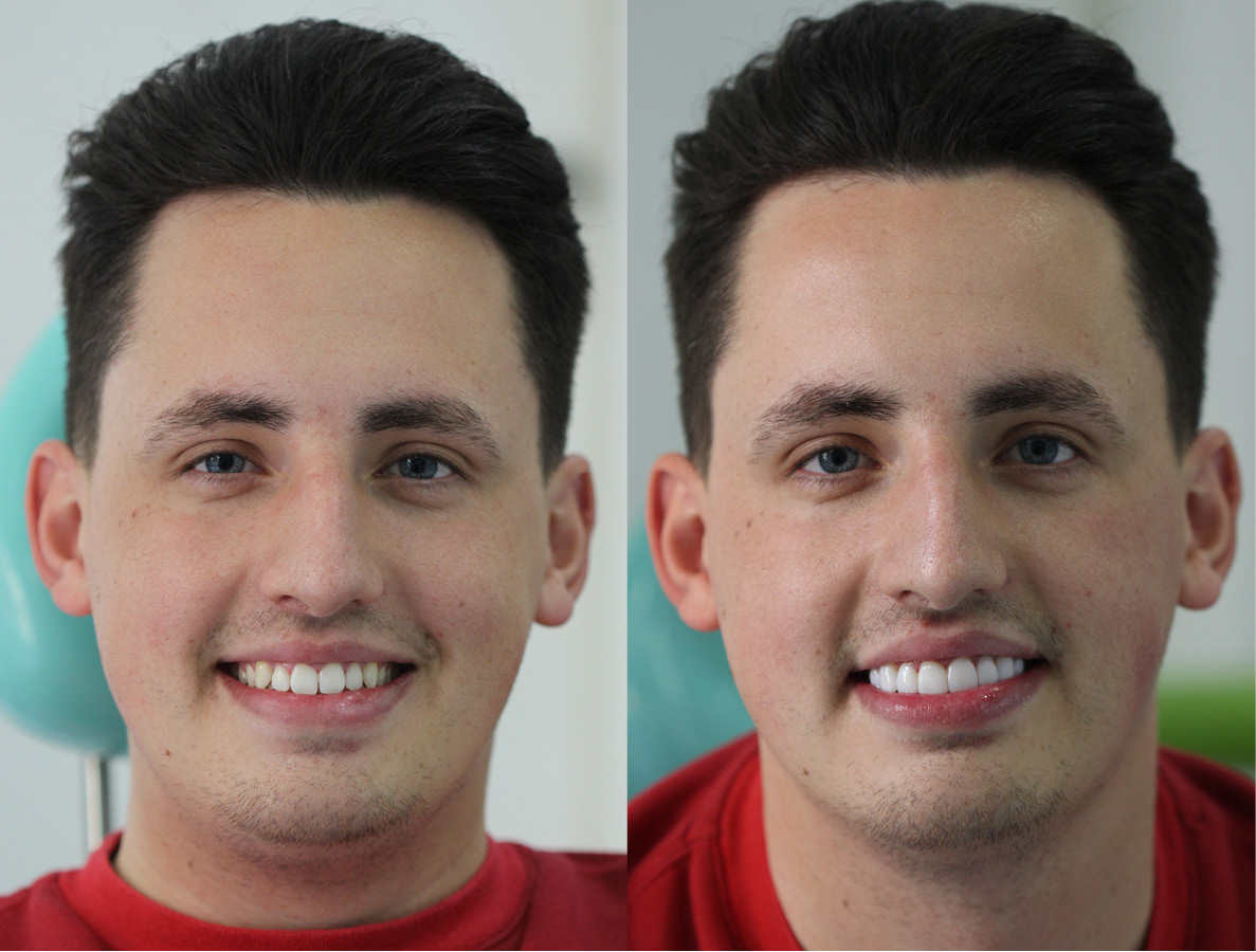 Gallery Smile Lab Design